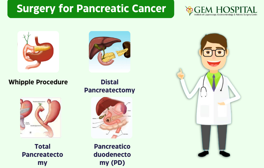 Pancreatic Cancer Treatment in Coimbatore | GEM Hospitals