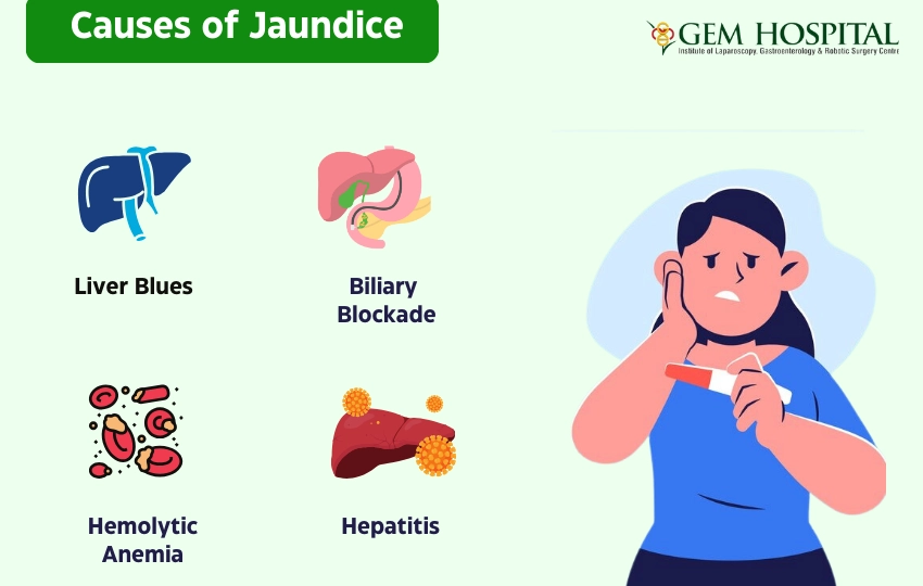 Best Doctors for Jaundice in Coimbatore | GEM Hospitals